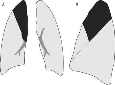 Ovid: Chest Radiology: The Essentials